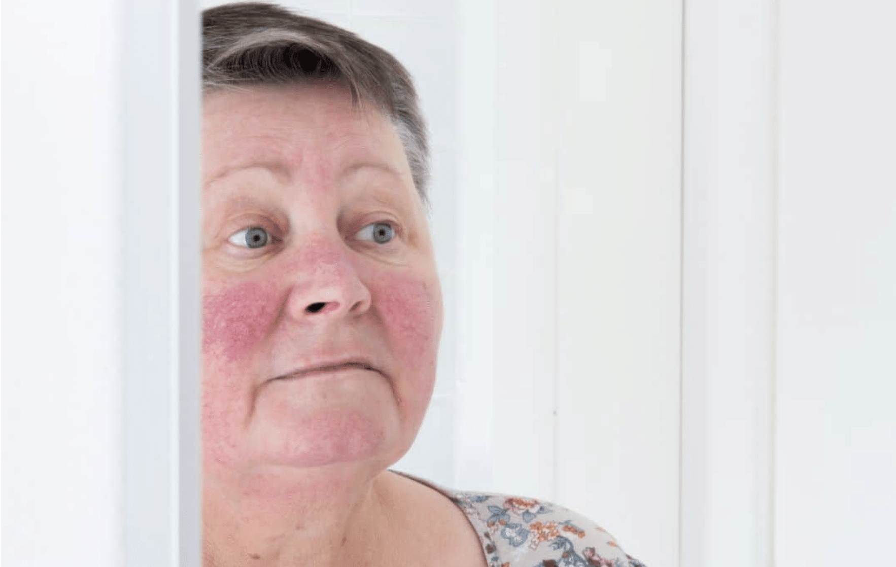 Tips for reducing redness and rosacea - SkinSmart Dermatology